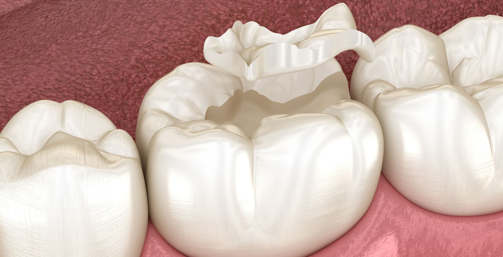 Skin Needling Treatment: Benefits and What to Expect